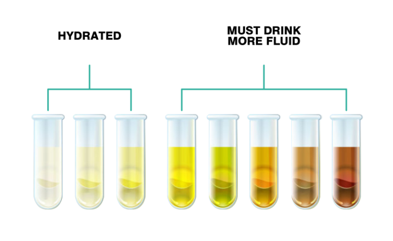 How Urine Color Indicates Your Child’s Hydration Levels - Kids and ...